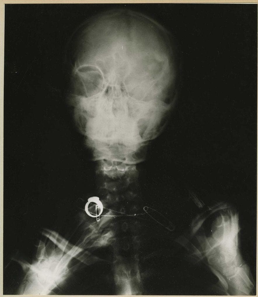 14 Horrifying Facts You Didn't Know About The Radium Girls