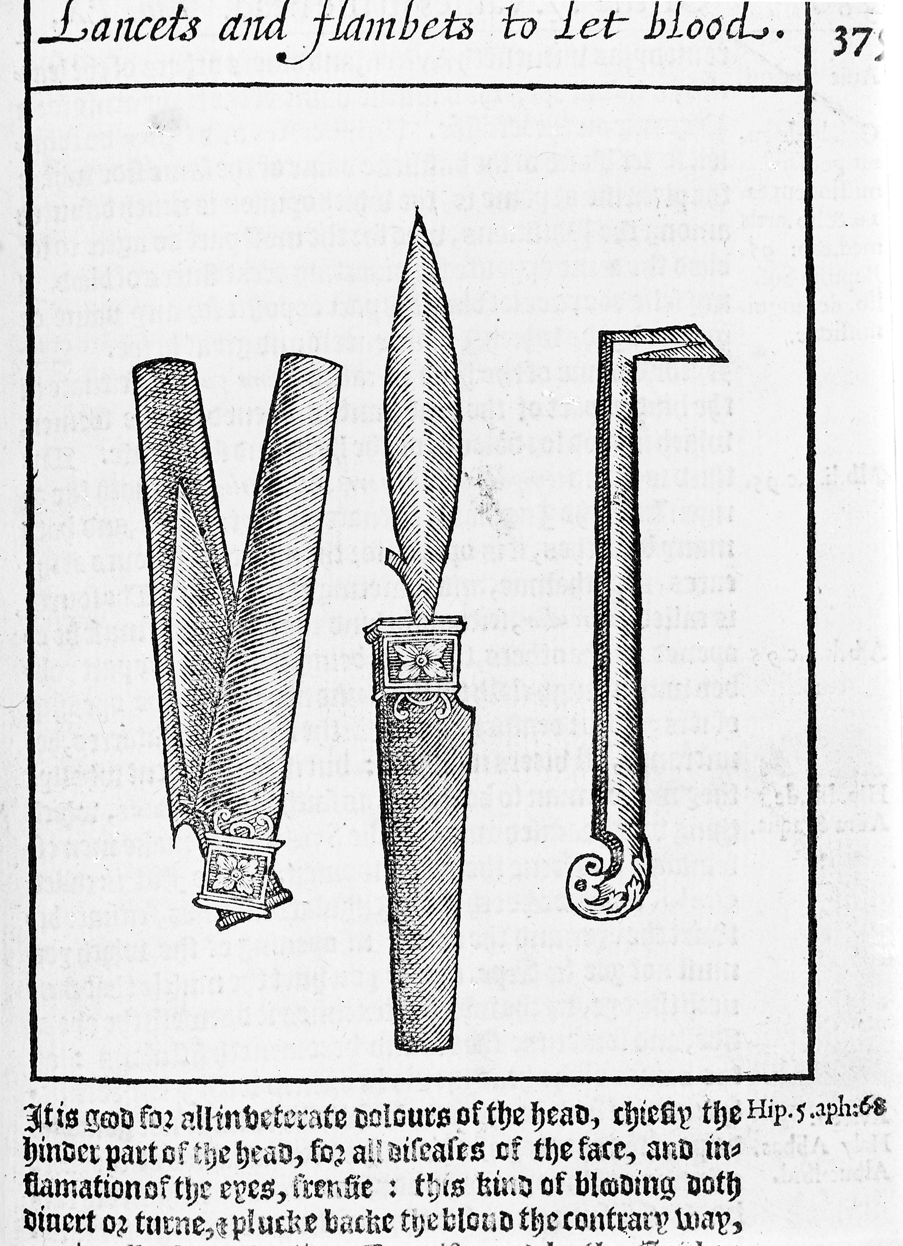 The Horrifying History Of Bloodletting And Leeching