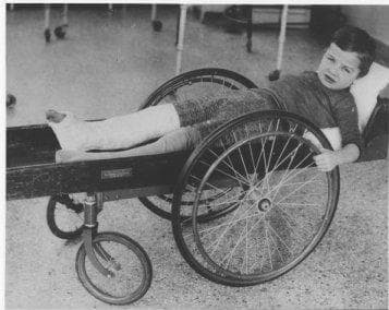 12 Terrifying Medical Devices From the 1900s (Photos)