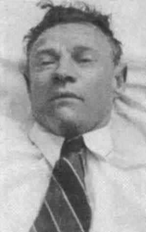 Inside The Everlasting Mystery Of The Somerton Man Corpse