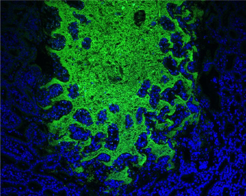 The Organisms That Eat Your Corpse, From Just After Death To The End