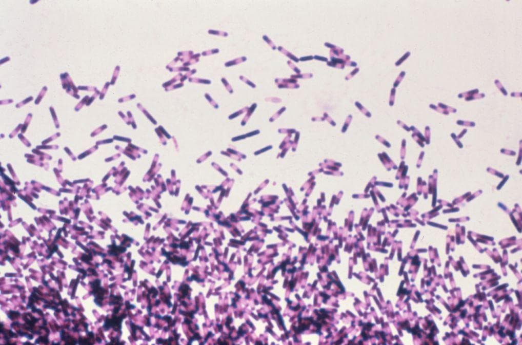 The Organisms That Eat Your Corpse, From Just After Death To The End