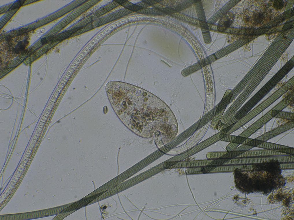 The Organisms That Eat Your Corpse, From Just After Death To The End