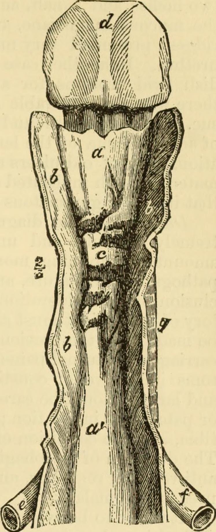 The Worst Things People Did To Themselves In The Name Of Medical Science: