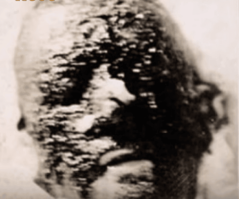 12 Horrifying Facts About The First Man To Have Plastic Surgery