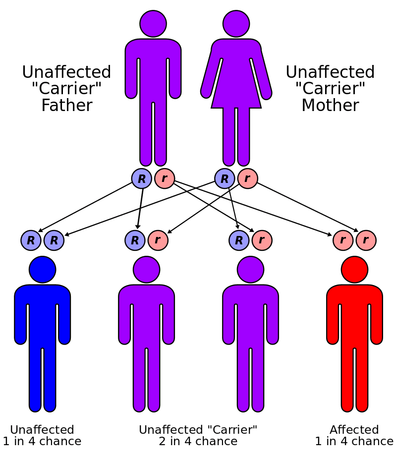 15 Fascinating Facts About Progeria, The Rapid Aging Disease