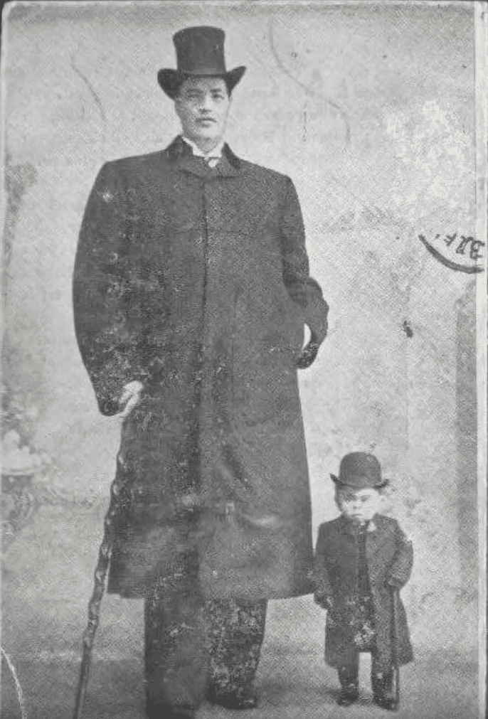 The Bizarre Saga of Adam Rainer, the Only Person Ever To Be A Dwarf And ...