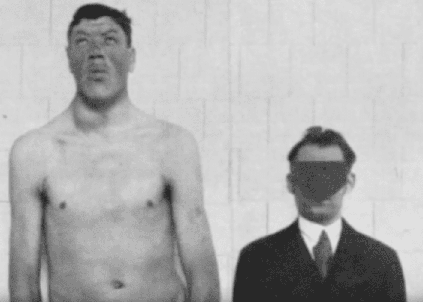 The Bizarre Saga of Adam Rainer, the Only Person Ever To Be A Dwarf And ...