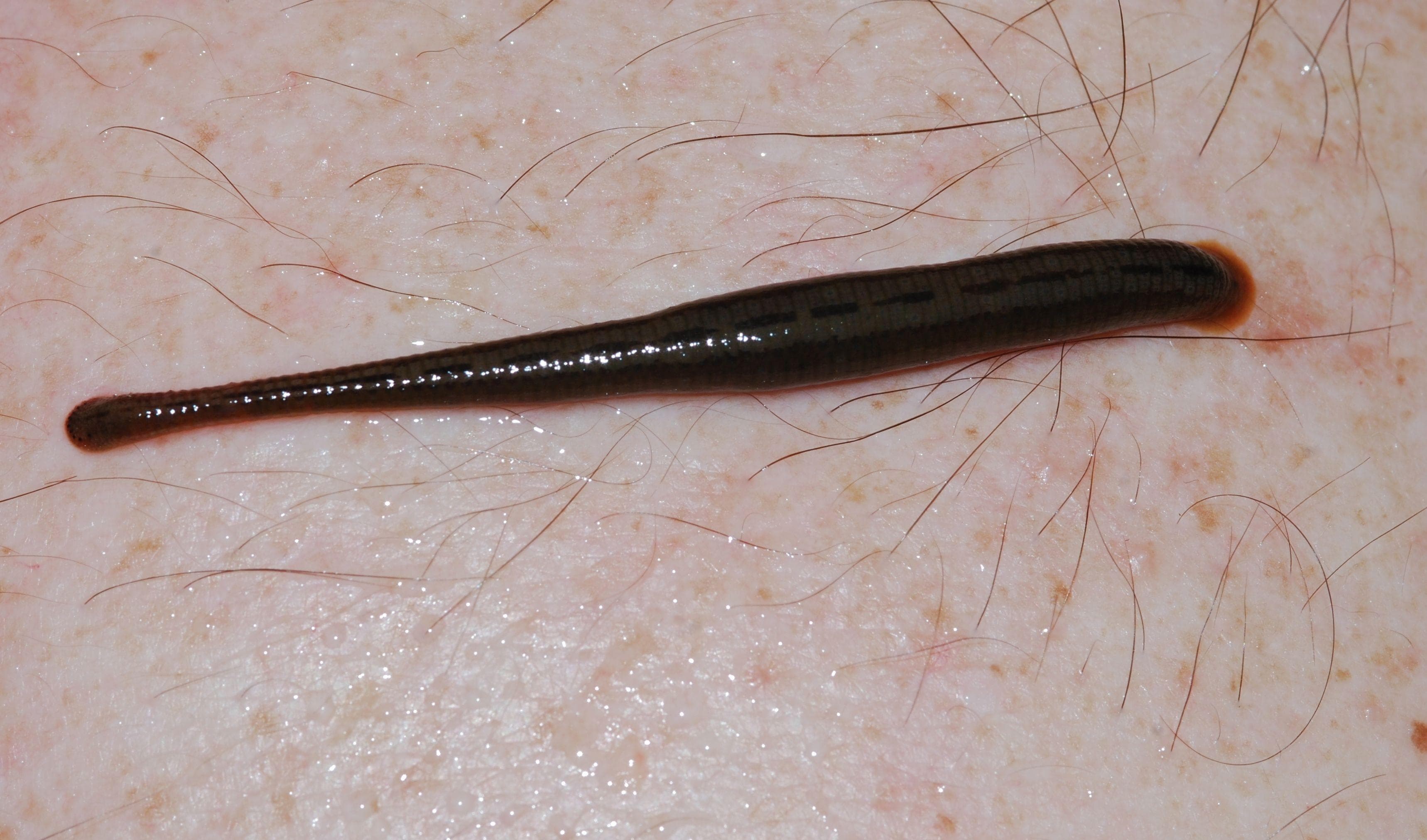 12 Bizarre Facts About Bloodsucking Leeches