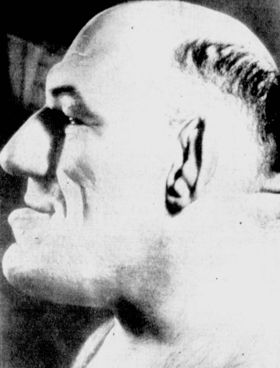 These Photographs Show The Tragic Story Of The Kind-Hearted Real Life Shrek