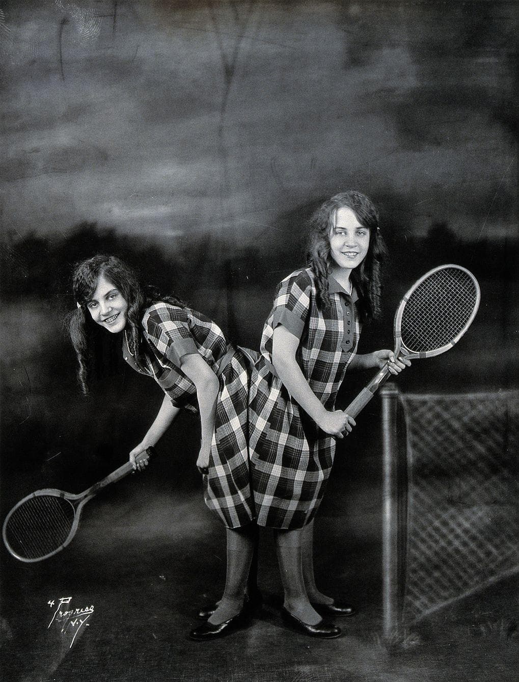 The Tragic Lives Of Conjoined Twins Daisy & Violet Hilton