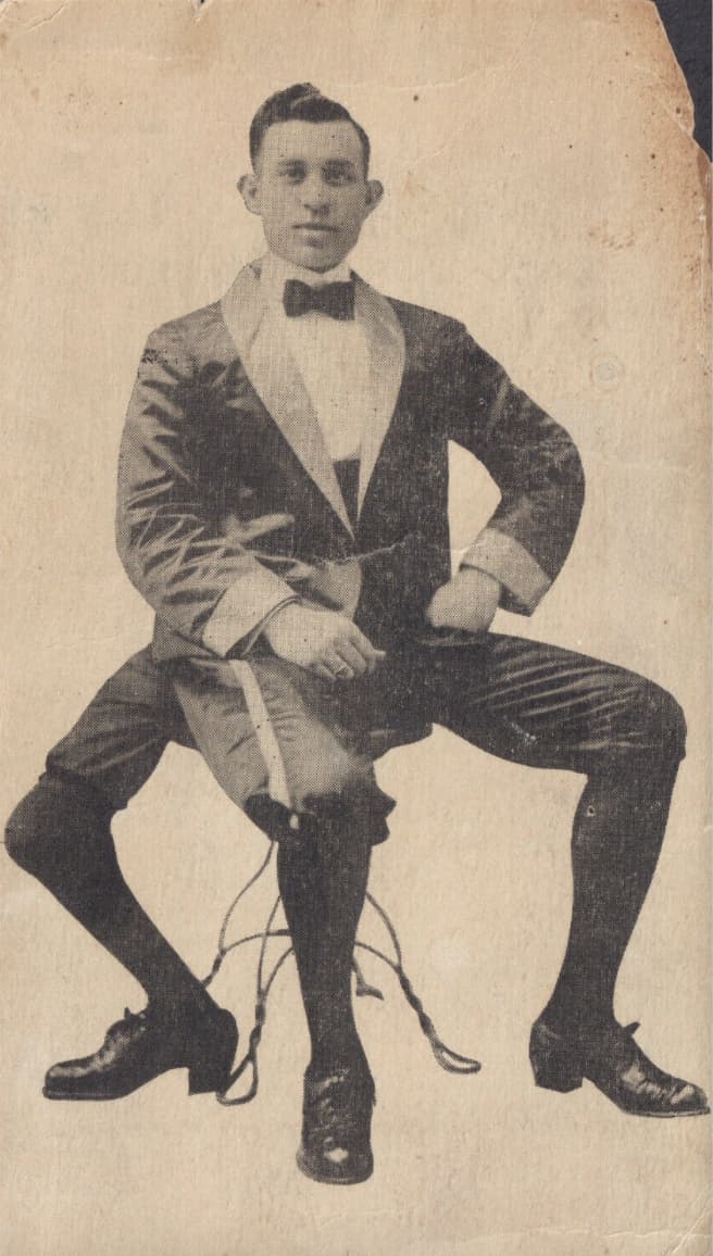 The Strange Life Of Frank Lentini, "The Three-Legged Wonder"