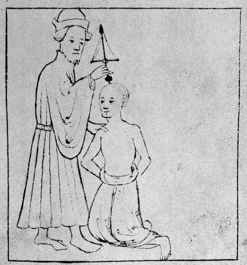 The History of Trepanning: Why Humans Drilled Holes In Their Skulls
