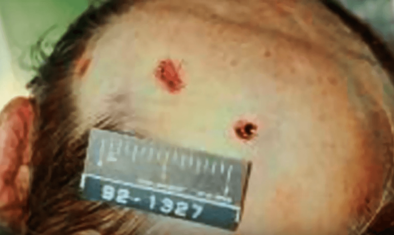 Meet Grady Stiles, The Murderous Lobster Boy Who Killed His Daughter's ...