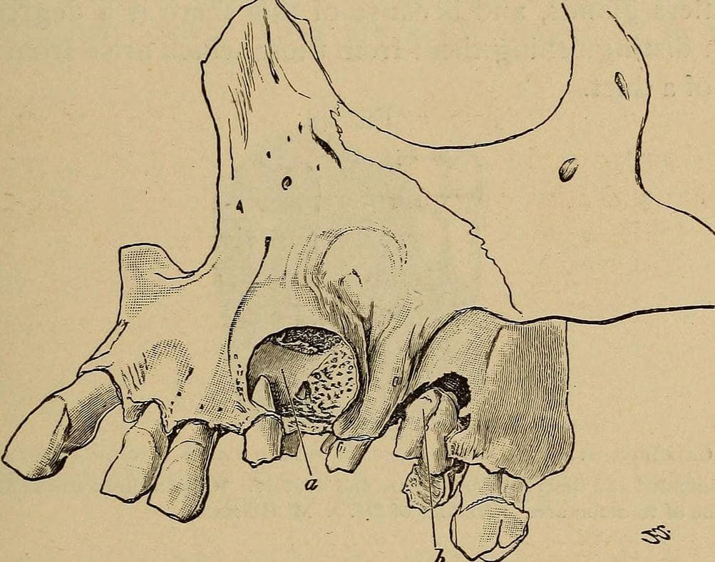 The Disturbing Consequences Of Putting Radium Into Common Products