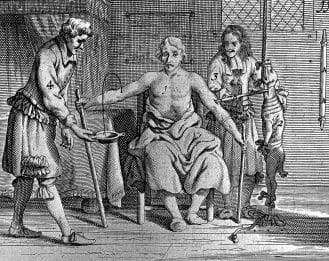 The Bizarre Saga of the Guy Who Got A Sheep's Blood Transfusion And ...
