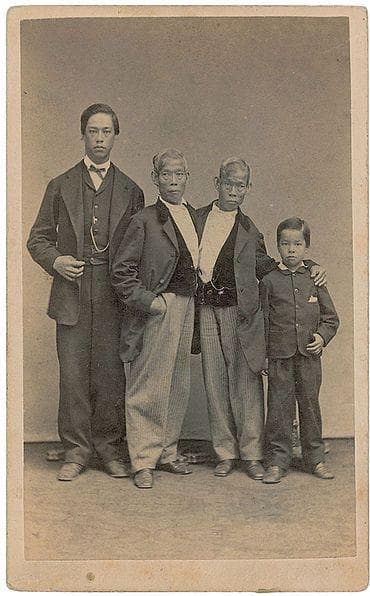 The Strange Lives Of Chang And Eng Bunker, The Original Siamese Twins