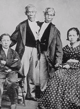 The Strange Lives Of Chang And Eng Bunker, The Original Siamese Twins