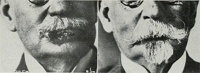 The Disturbing Consequences Of Putting Radium Into Common Products