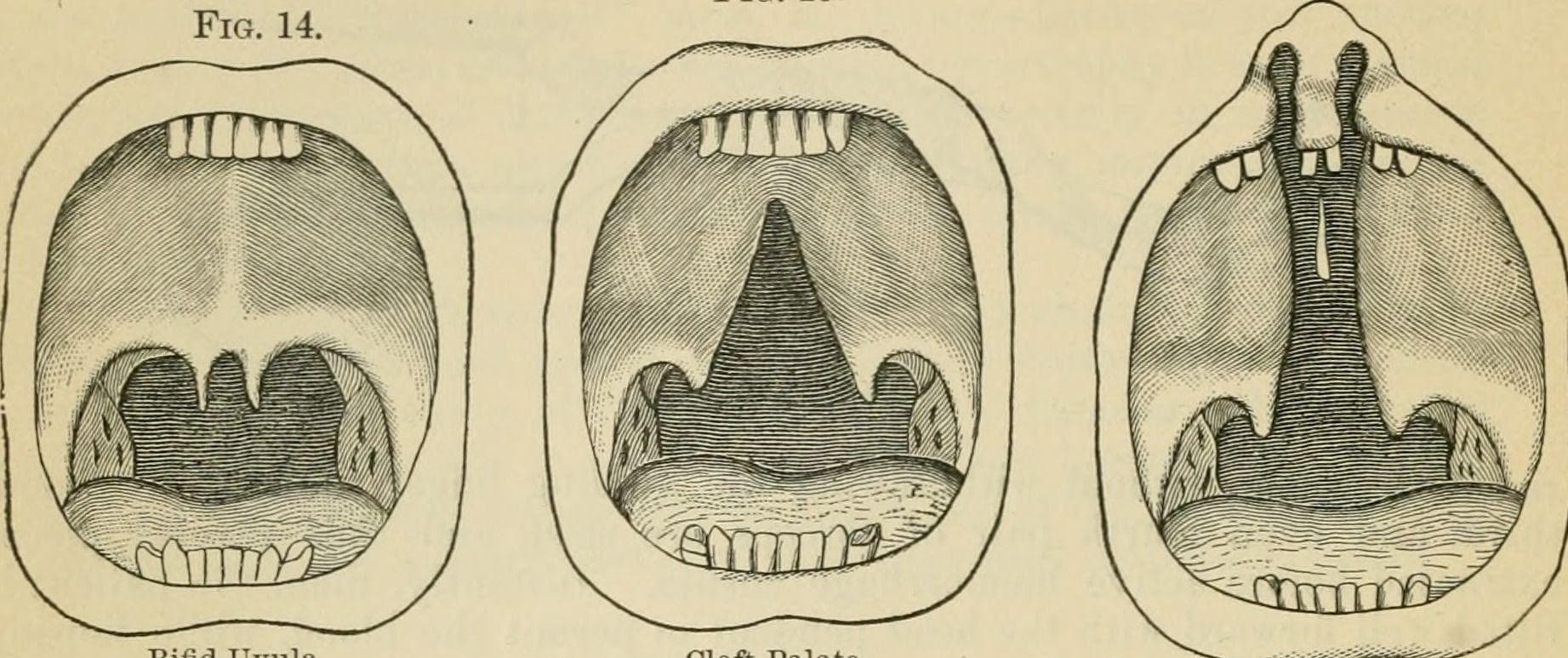 The Horrifying Story Of The Man Who Rotted Internally From Radiation ...