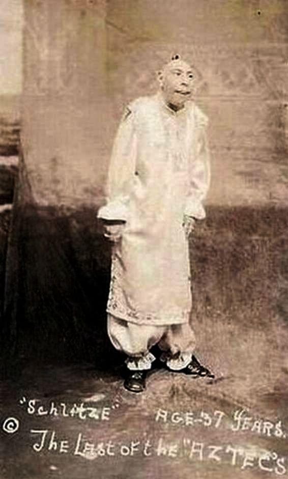 The Strange Life And Times Of Schlitzie, The "Pinhead" From Freaks