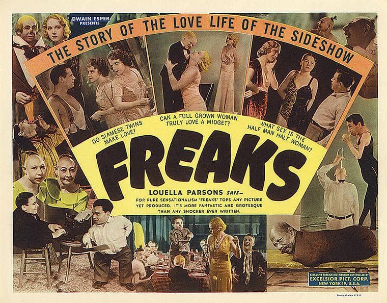 The Strange Life And Times Of Schlitzie, The "Pinhead" From Freaks