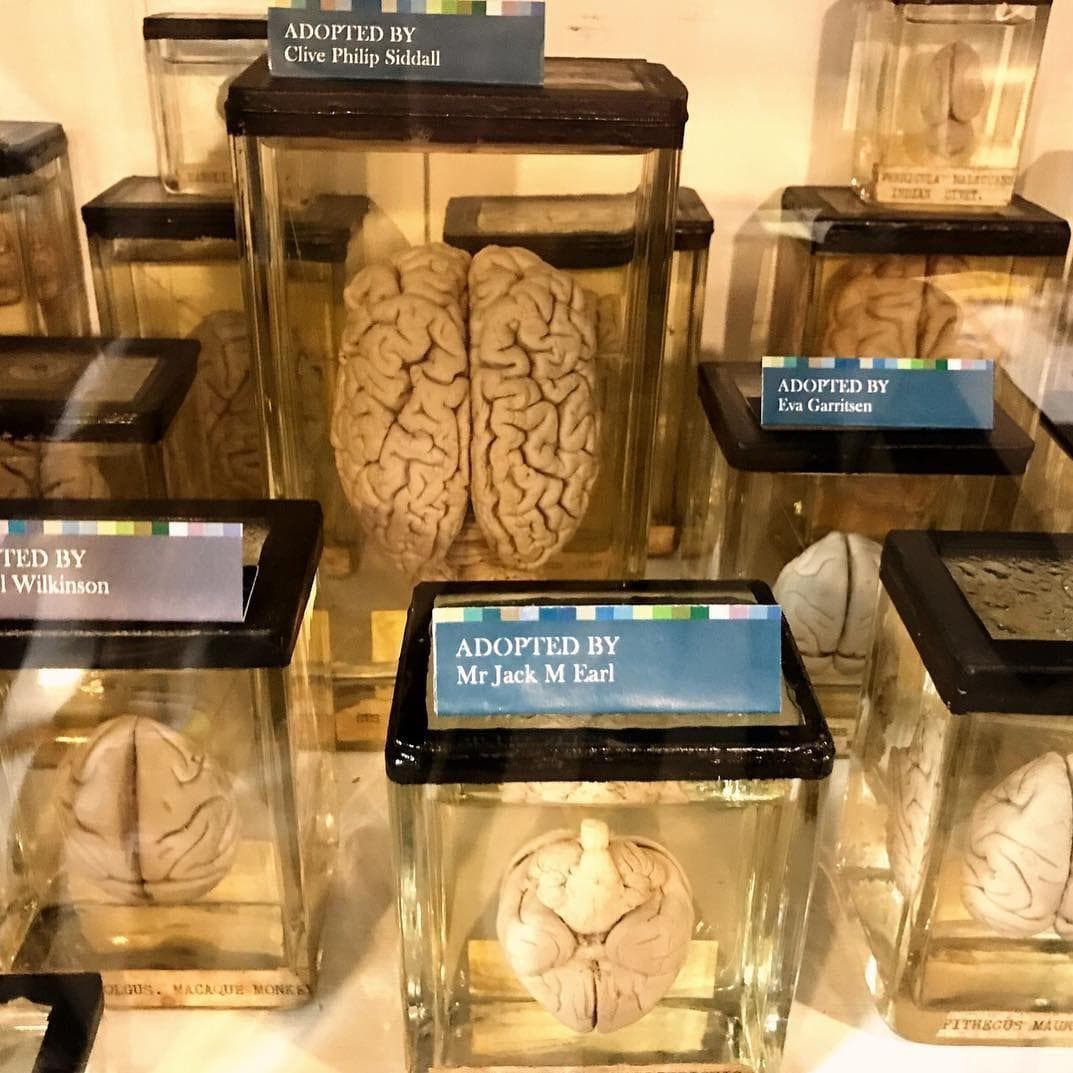 Super Creepy Pictures From London's Museum Of Pickled Animals