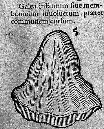 Historical Superstitions About The Caul, The Amniotic Membrane That Has ...