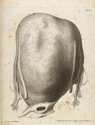 Historical Superstitions About The Caul, The Amniotic Membrane That Has ...