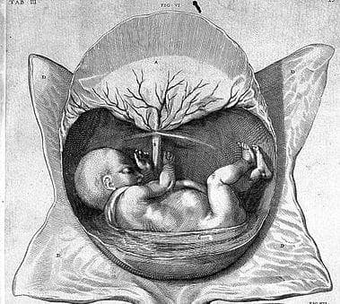 Historical Superstitions About The Caul, The Amniotic Membrane That Has ...