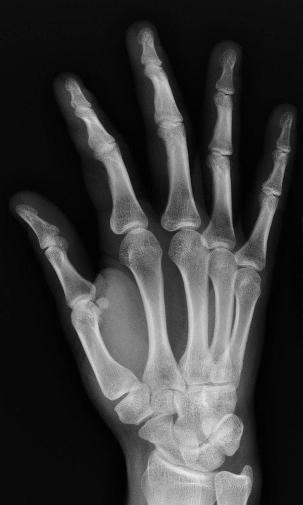 All The Things That Thomas Edison Didn't Actually Invent, But Took The ...