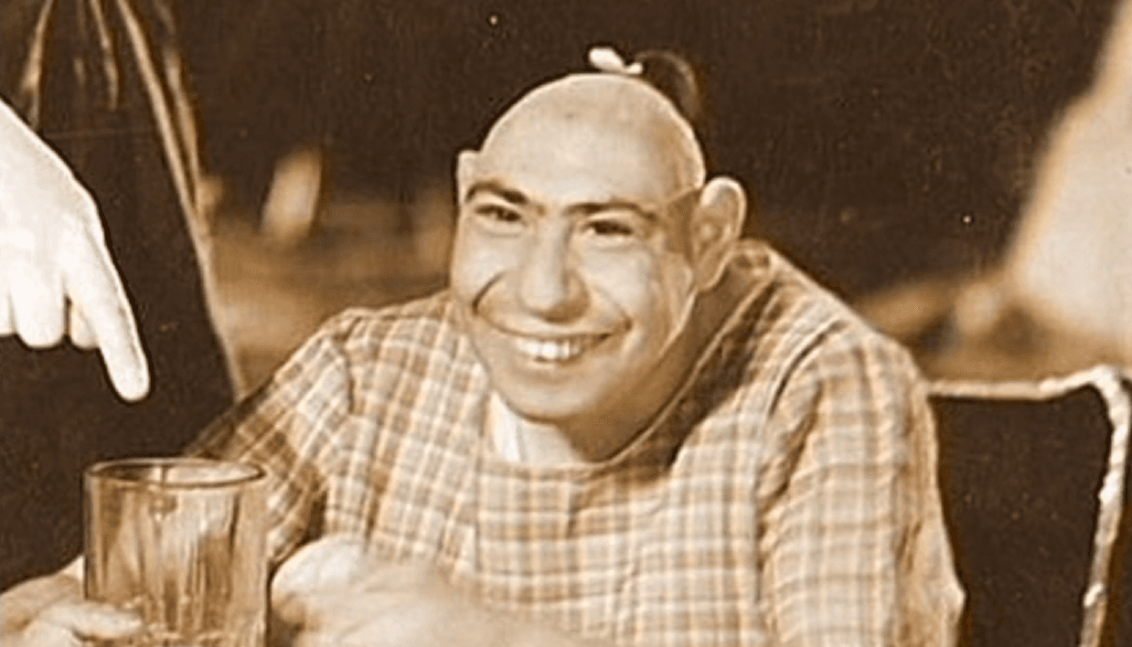 The Strange Life And Times Of Schlitzie, The "Pinhead" From Freaks
