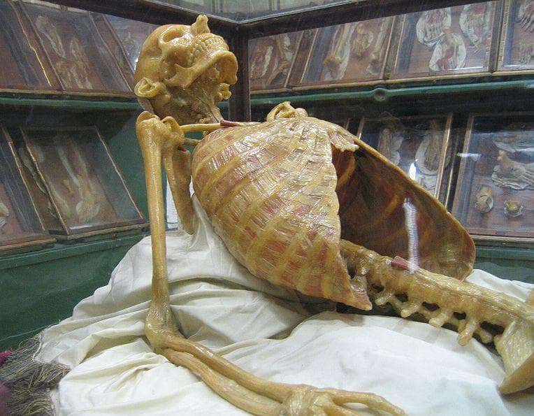 These Grotesque 18th Century Wax Models Were Made From Real Cadavers