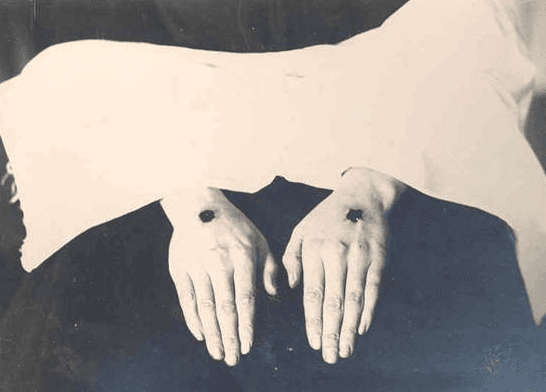 Scientists Just Discovered The Medical Explanation For Stigmata