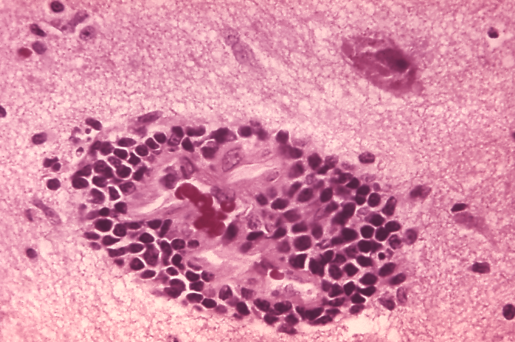 Here's What Happens to Your Body When You Get Rabies