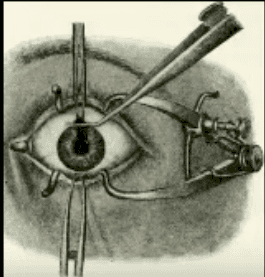 The Creepy History of Optography