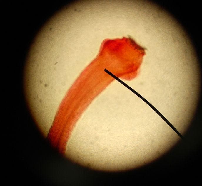 Here's What Happens To Your Body When You Eat A Tapeworm
