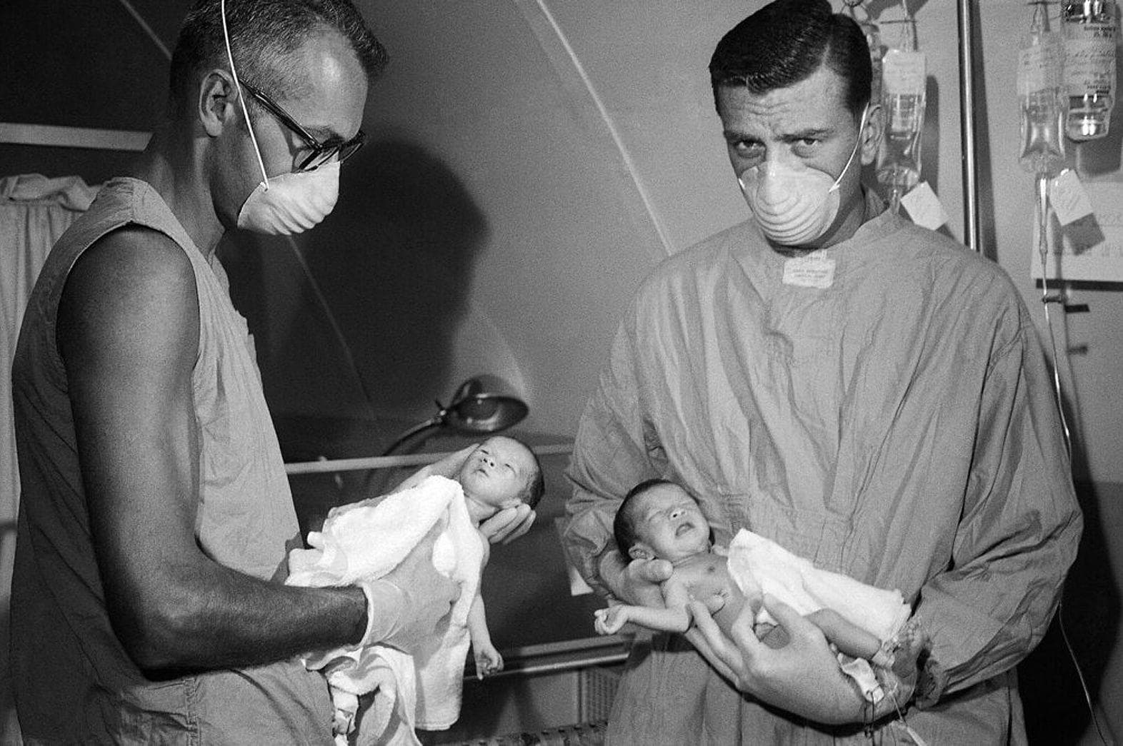 Real Answers To Questions You've Always Had About Conjoined Twins