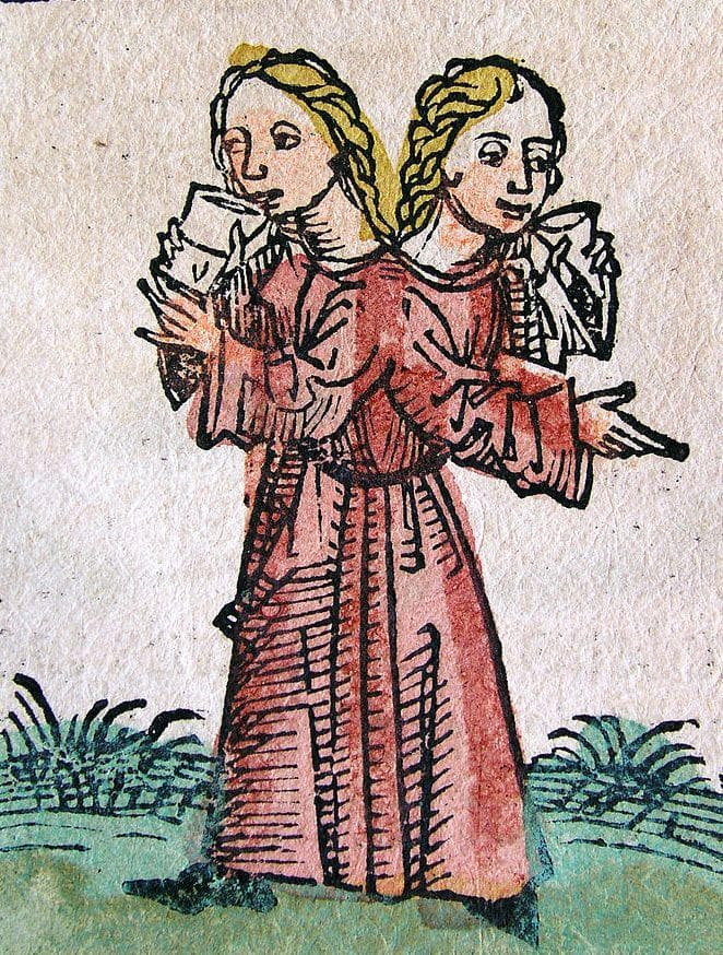 Real Answers To Questions You've Always Had About Conjoined Twins