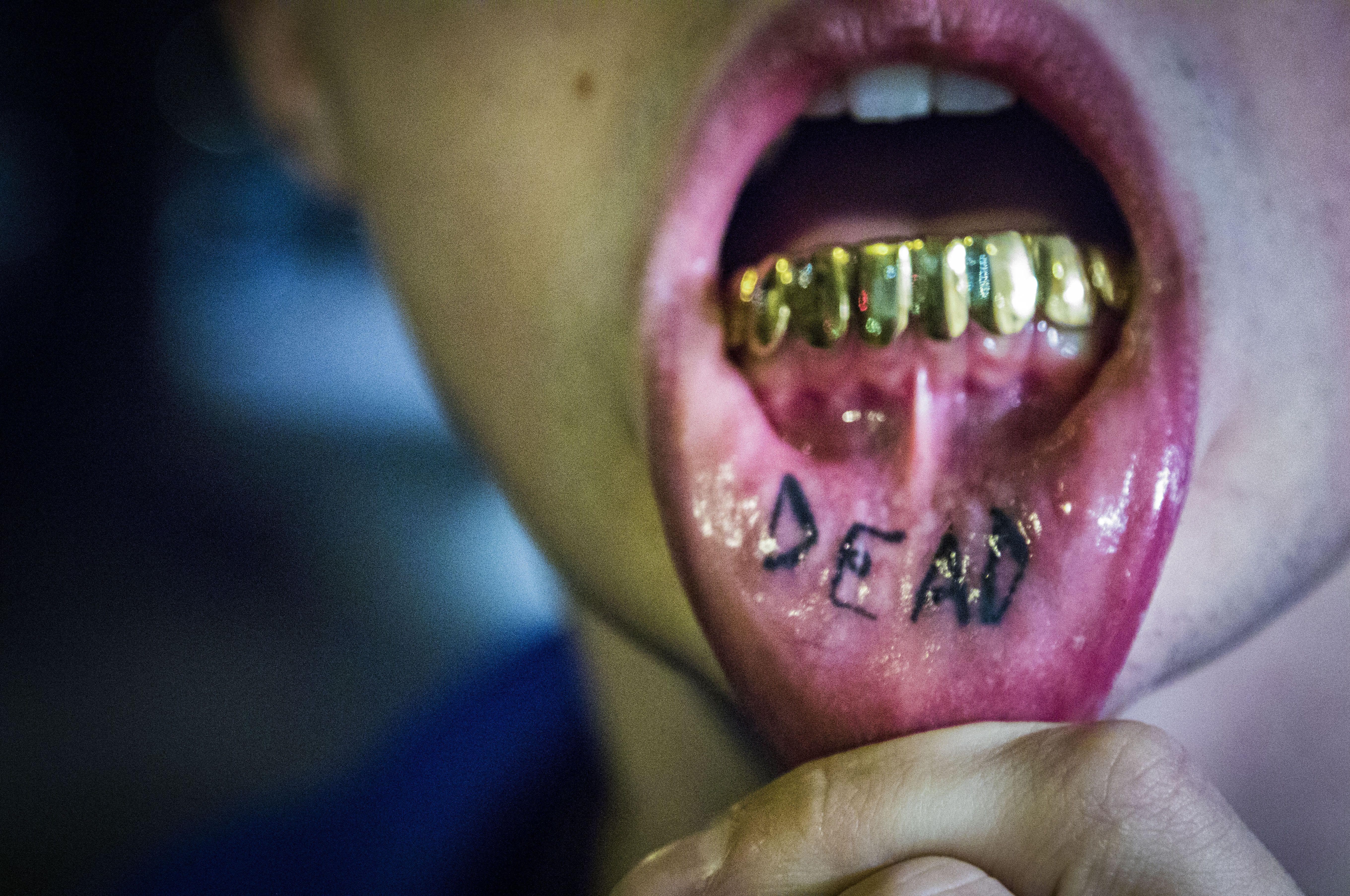 Here Is Every Nightmare You've Ever Had About Your Teeth Explained