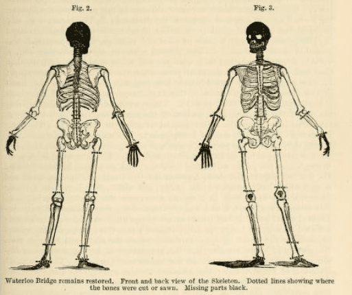 Fascinating Victorian Attempts At Forensic Investigation