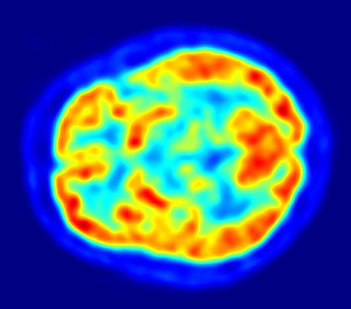 12 Creepy But Fascinating Facts About The Human Brain