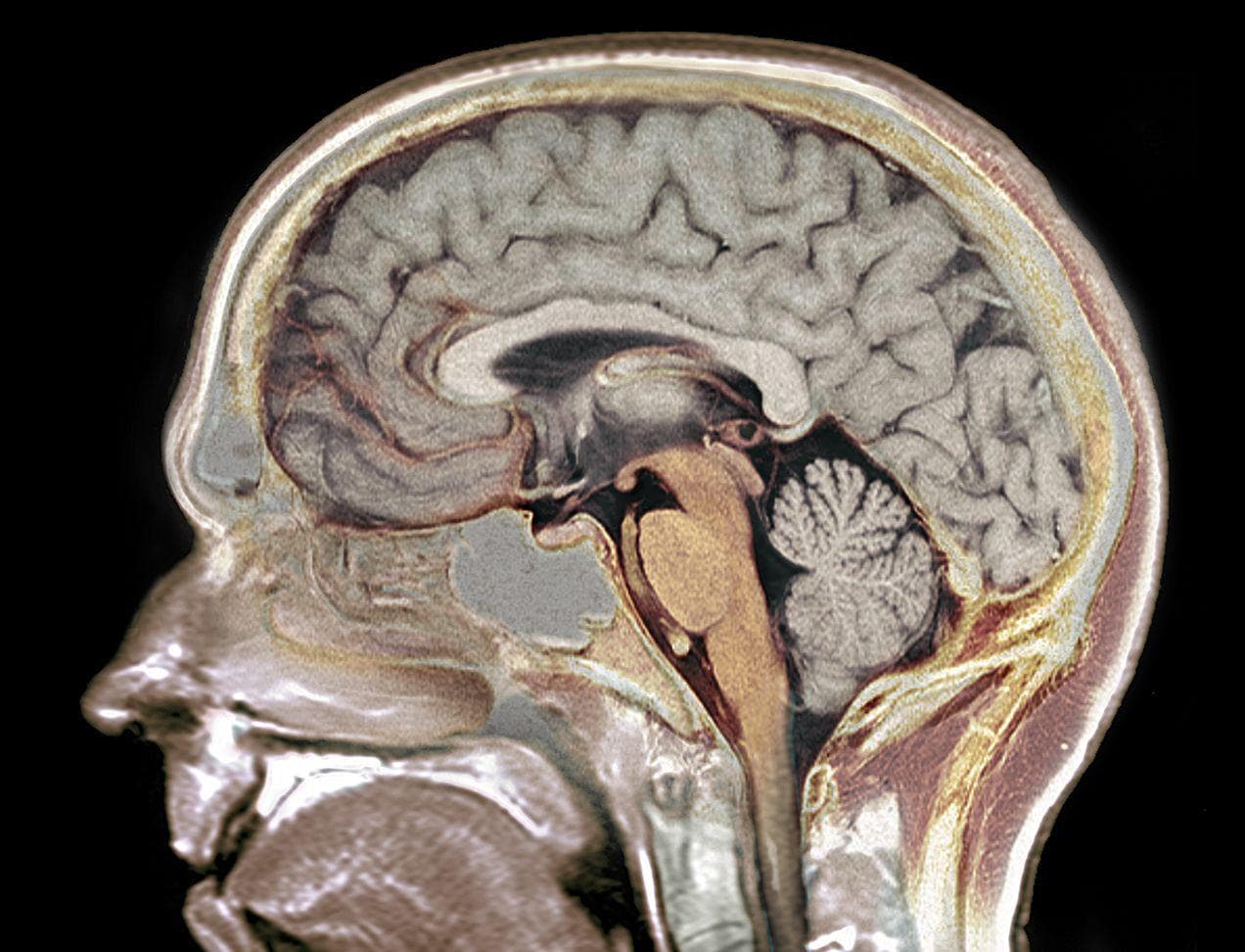 12 Creepy But Fascinating Facts About The Human Brain