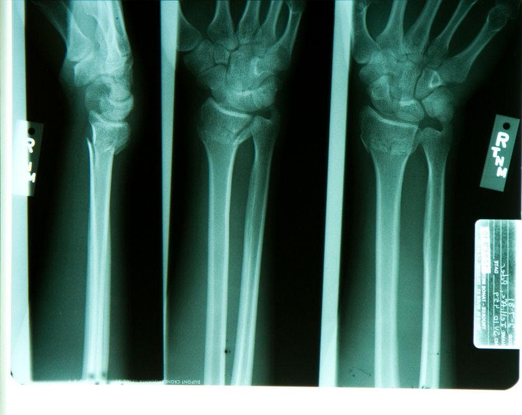 17 Extremely Rare Genetic Features That You Probably Don't Have