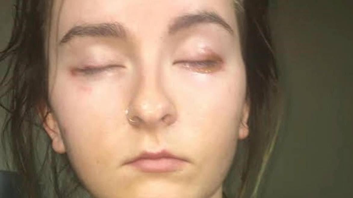 These Lash Extension Horror Stories Will Make You Second Guess That ...