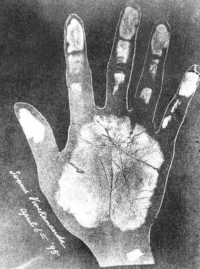 Here Are All The Things You Really Don't Want To See On Your Hand ...