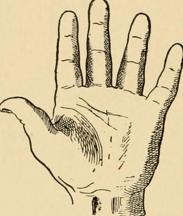 Here Are All The Things You Really Don't Want To See On Your Hand ...