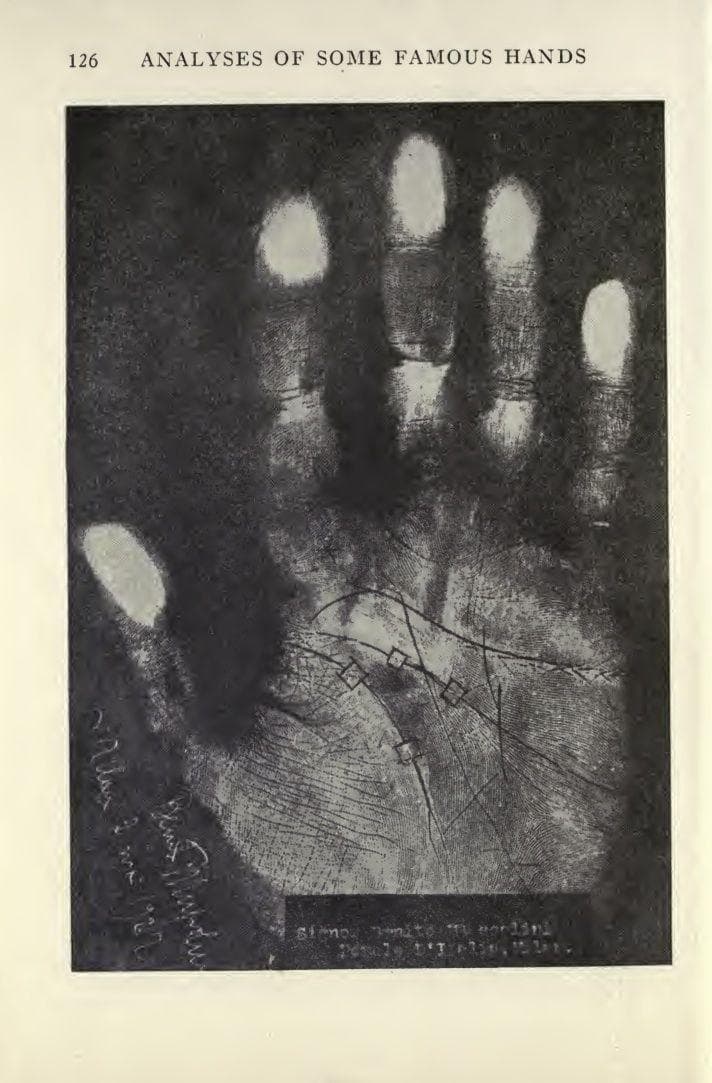 Here's What A Professional Palm Reader Predicted From Hitler's Hand Print