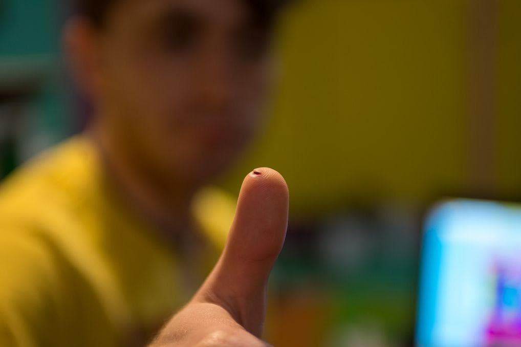 Here Is The Real Reason Why Paper Cuts Hurt So Badly