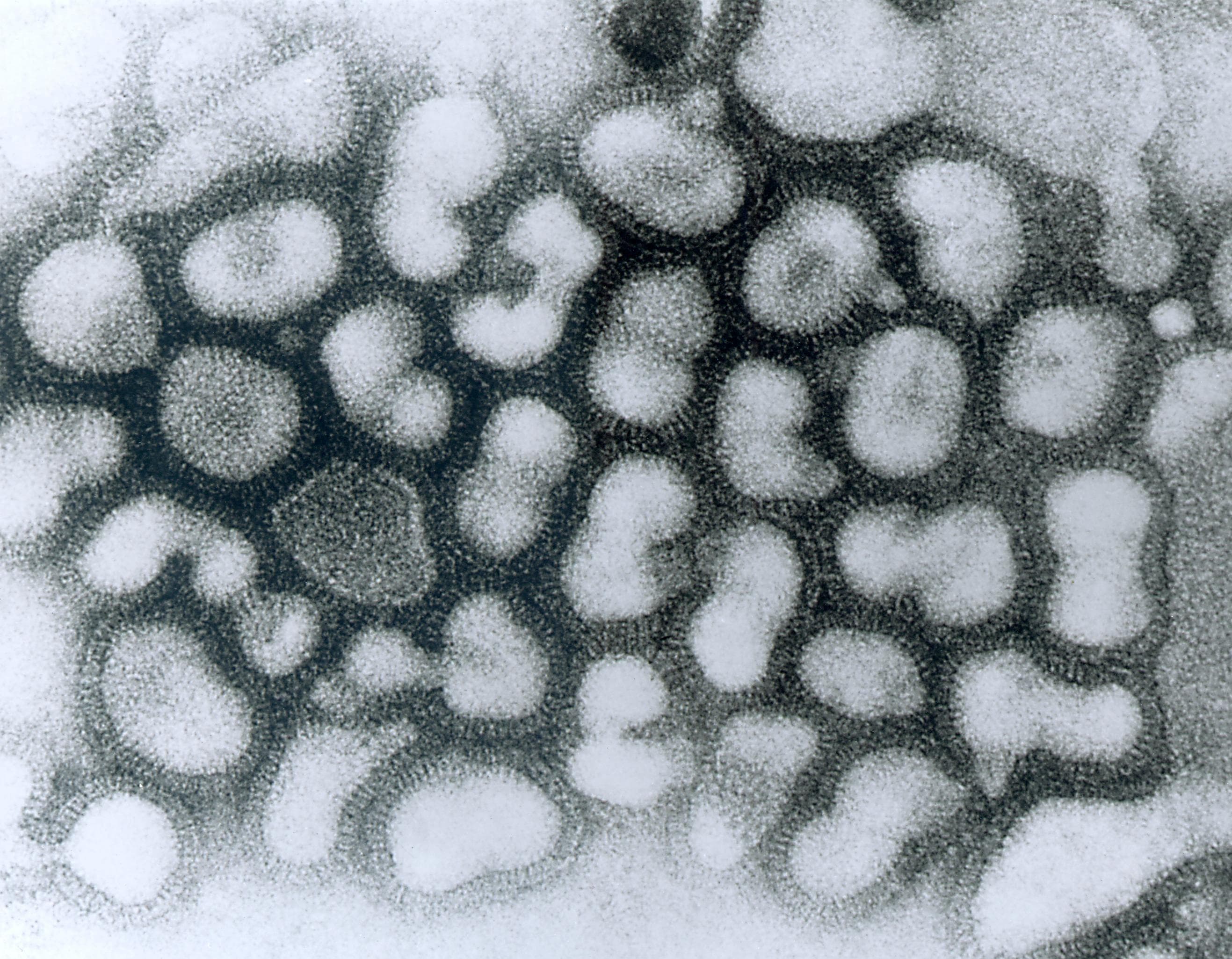 The Worst Flu Outbreaks In US History
